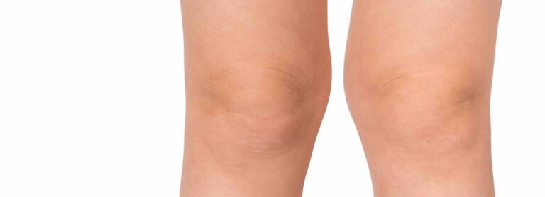 Knee Pain Treatment | Physio & Sports Therapy Kenilworth